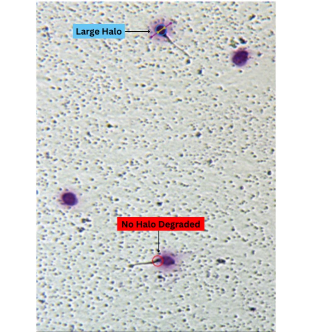 Advanced Semen Analysis Test Kit DNA Fragmentation Fertility Report advanced-semen-analysis-test-kit-dna-fragmentation-fertility-report